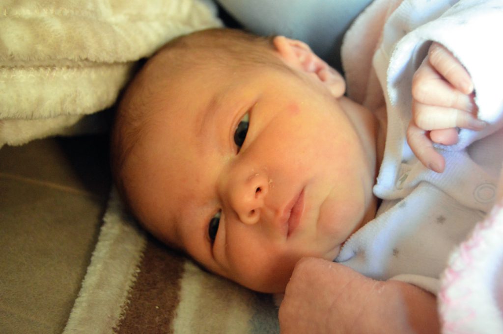 Mi bebé se está poniendo amarillo ¿Es normal? • Cuidados y Caricias